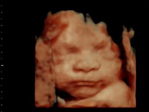 8k Baby Ultrasound Image - Transform 3D and 4D Ultrasound Scans